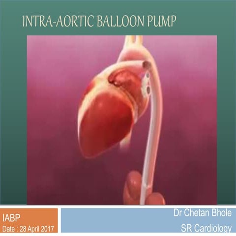 INTRA AORTIC BALLON PUMP (IABP) | PPT