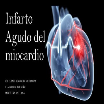 Infarto Agudo al Miocardio corto IAM NFARTO | PPTX