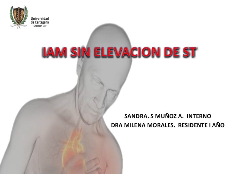 IAM SIN ELEVACION DEL ST ( UDC)