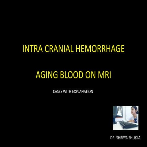 INTRA CRANIAL HEMORRHAGE- AGING BLOOD ON MRI | PPTX