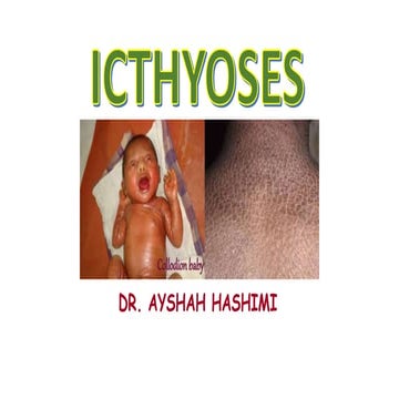 Ichthyoses | PPT