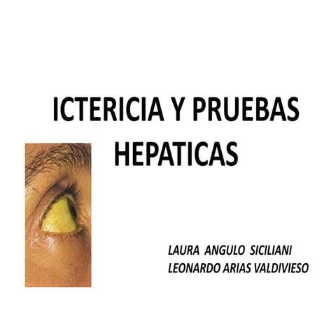Ictericia | PPTX