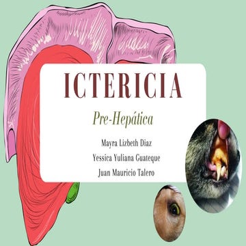 Ictericia Pre-Hepática.pdf