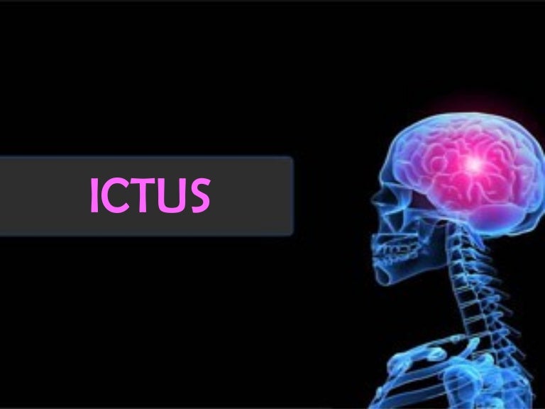 Ictus!!