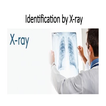 Age estimation by radiological method (using X-rays) | PPTX