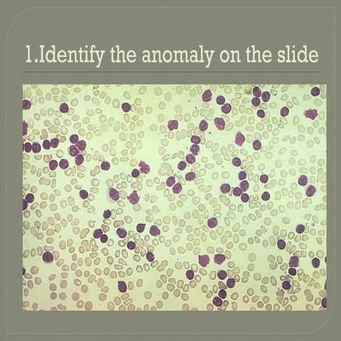 how to Identify this abnormal red cell.pptx