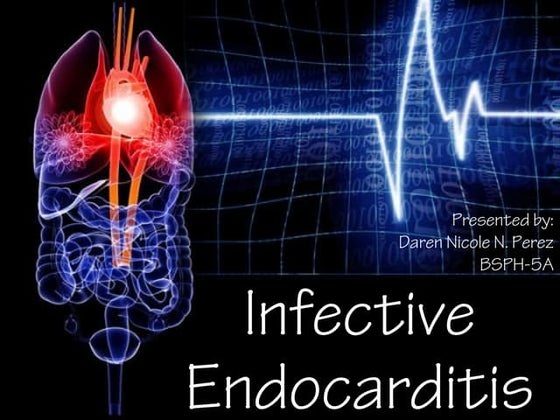 Infective endocarditis Echocardiography | PPT