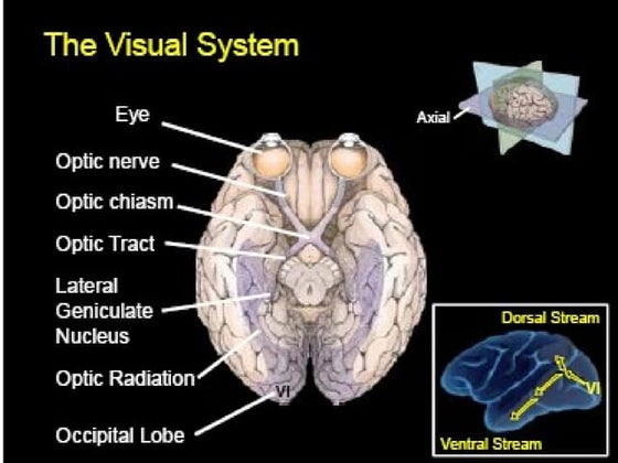 Field changes in glaucoma | DOC | Eye and Vision Conditions | Diseases ...