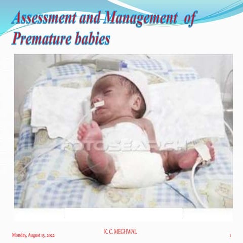ASSESSMENT & MANAGEMENT OF PRETERM BABIES .pptx