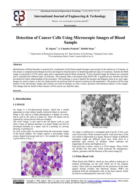 Classification of Leukemia Detection in Human Blood Sample Based on ...