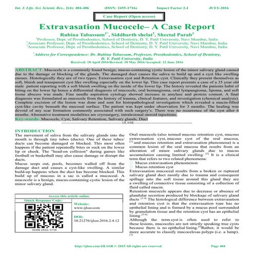 Extravasation Mucocele– A Case Report | PDF