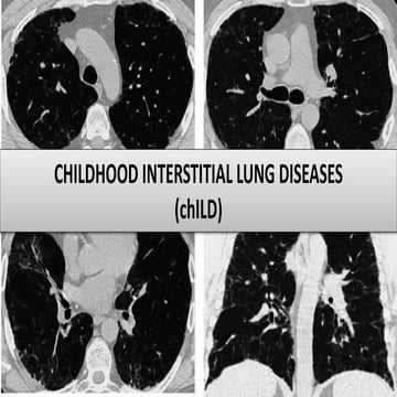 Childhood Interstitial lung disease (ILD) | PPTX