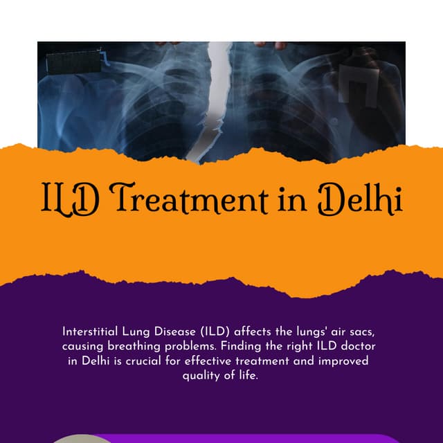 ILD treatment specialist doctor in Delhi, India Dr. Vikas Mittal.pdf