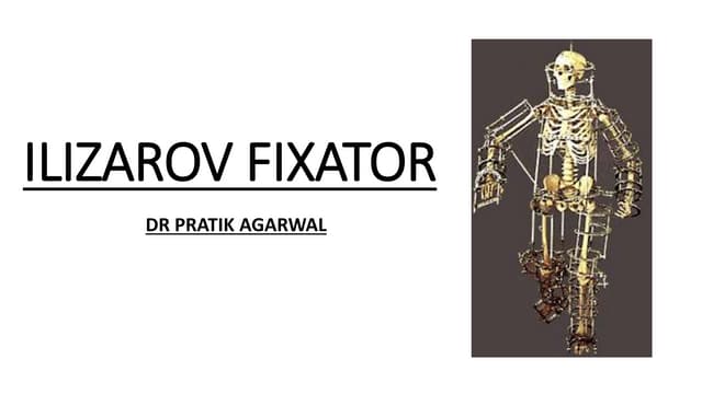 Introduction-to-the-Ilizarov-Fixator.pptx