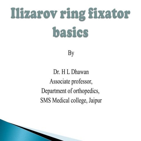 ilizarov basics.ppt powerpoint presentation. | PPT