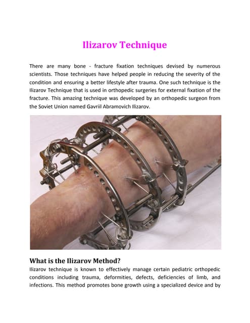 Introduction-to-the-Ilizarov-Fixator.pptx | Physical Therapy | Wellness