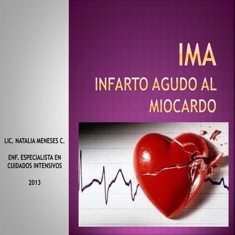 INFARTO AGUDO DE MIOCARDIO (IMA/ HEART ATTACK) | PPTX