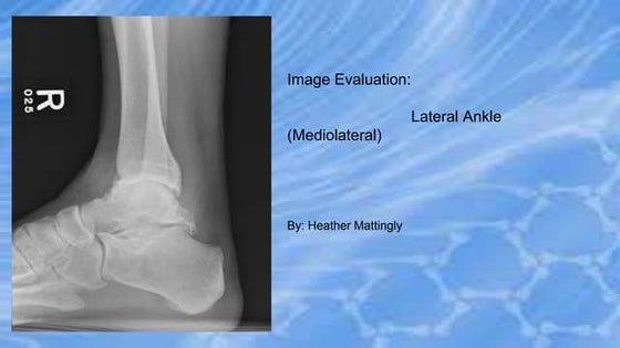 X-RAY views for foot, calcaneum, and ankle joint. | PDF