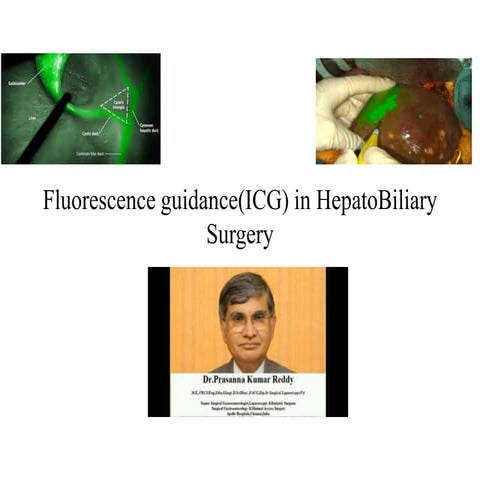 Role of Image guidance in THE HPB surgery.pptx