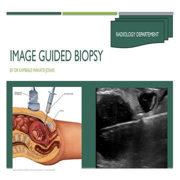 image guided biopsy bon CFCFCFHHCFJCFCF | PPTX