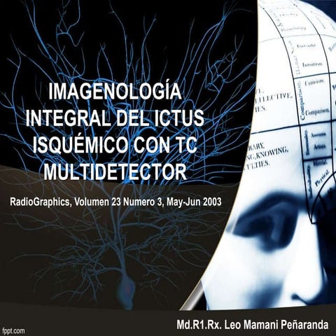 Neurologia escala de ASPECT evaluacion de un paciente neurologico | DOCX