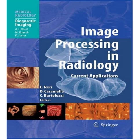 Image Processing Book | PDF