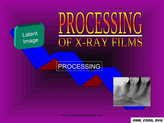 X ray film | PPTX