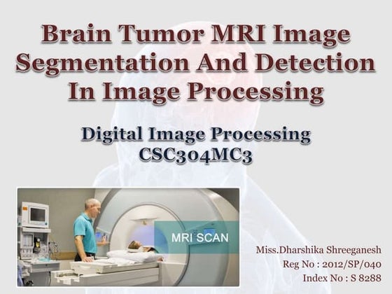 Brain Tumor Detection Using Image Processing Ppt 4558