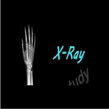 X-Ray | PDF