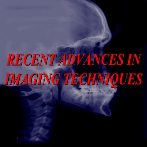 Imaging Ppt Wonderful Presentation New Ppt Ppt
