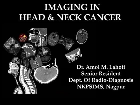 Lung cancer detection using digital image processing on ct scan images ...