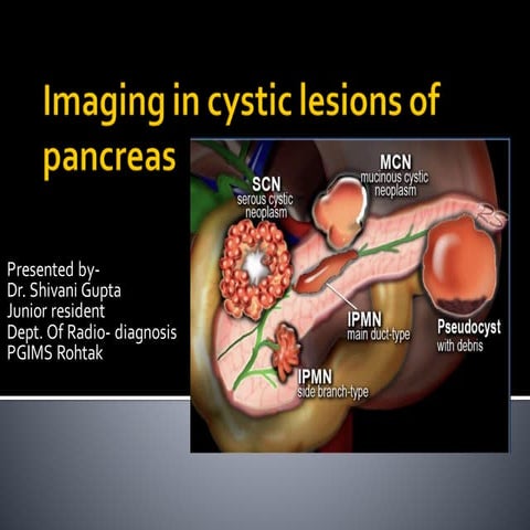 Imaging in cystic lesions of pancreas.pdf