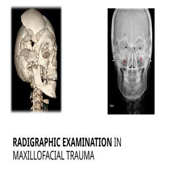 IMAGING MODALITIES IN ORAL AND MAXILLOFACIAL TRAUMA.pptx
