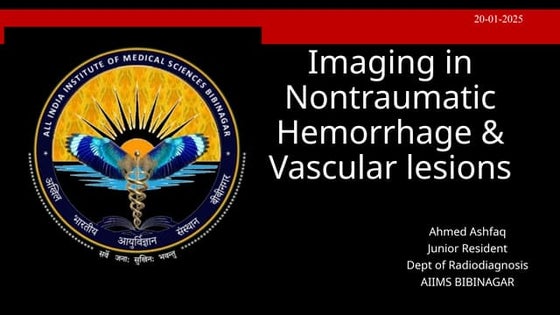 INTRA CRANIAL HEMORRHAGE- AGING BLOOD ON MRI | PPTX
