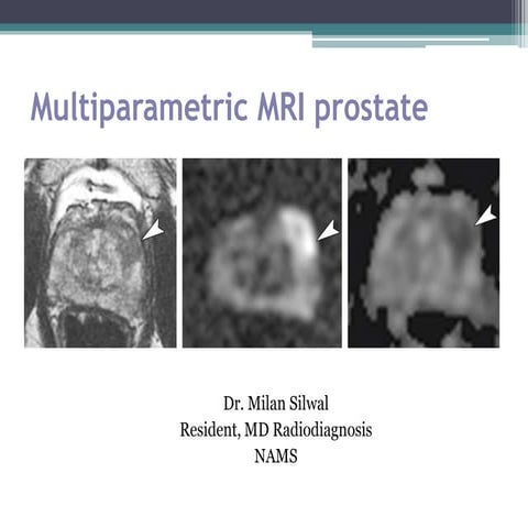 Prostate MRI anatomy from UNIVERSITY OF MICHIGAN | PPTX