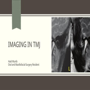 TMJ Imaging | PPTX