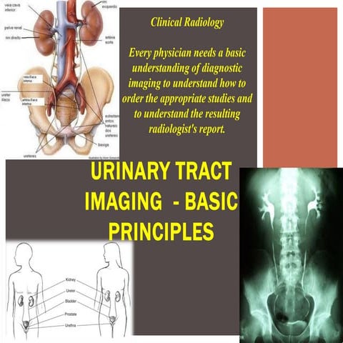 Intravenous urography (IVU) | PDF