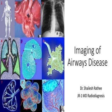 Imaging of large and small airway diseases.pptx