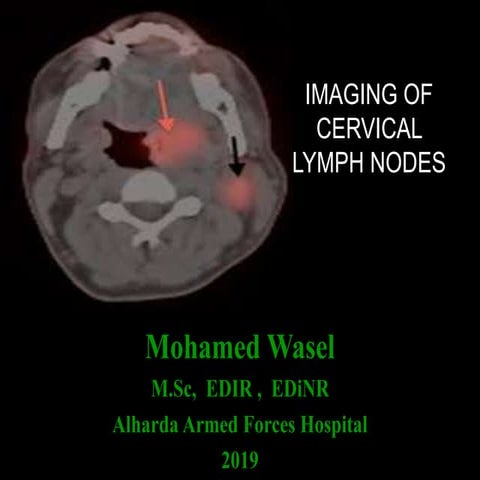 Imaging of cervical lymph nodes | PPTX