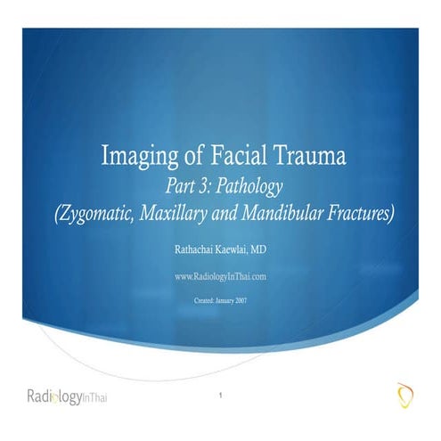 Imaging Of Facial Trauma Part 3 (2) 2 | PDF
