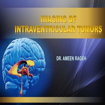 IMAGING OF INTRAVENTRICULAR TUMORS | PPTX