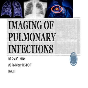 Imaging of pulmonary infections | PPTX