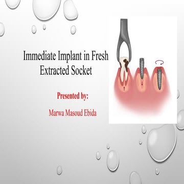 Immediate Implant in Fresh Extracted Socket.pptx