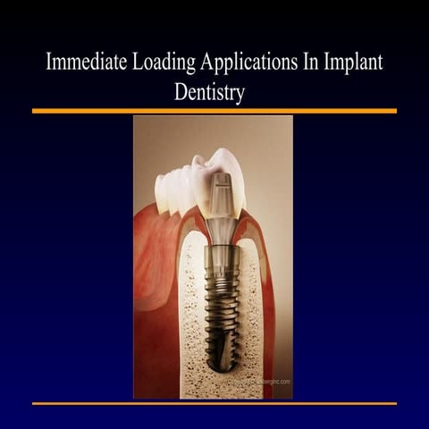 Loading protocols in implant | PPTX