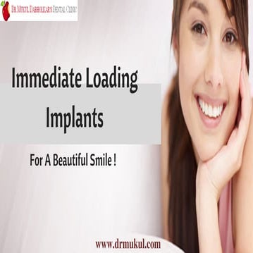 Immediate Loading Dental Implants In Bandra | Dental Implants In Mumbai | PDF