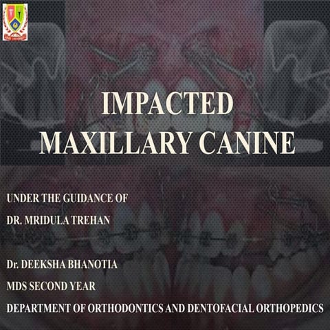 IMPACTED CANINE | PPTX
