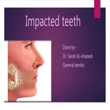 Impacted teeth / Dr.sarah alkhateeb | PPTX