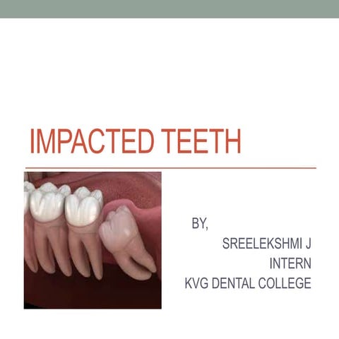 Impacted teeth | PPTX