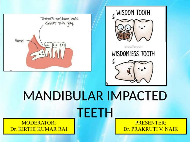 Radiographic assessment of impacted teeth | PPTX