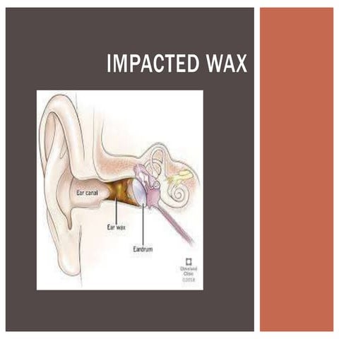 Impacted Wax And Nursing Care Pptx